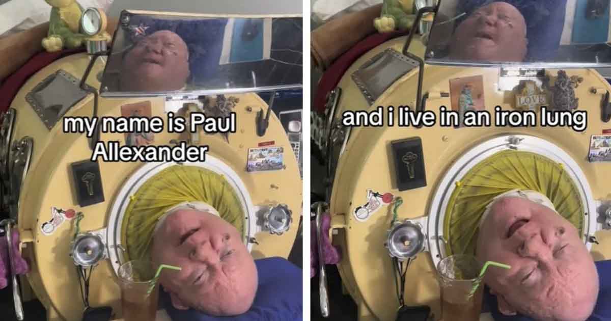 Remembering Paul Alexander, One Of The Last Polio Survivors Who Lived ...